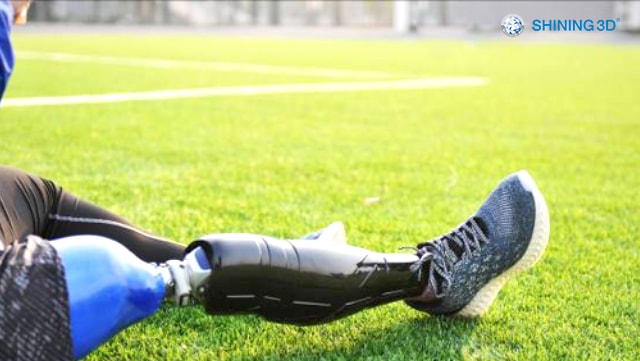 Customized Prosthetics Using the EinScan 3D Scanners – Afinia 3D Store